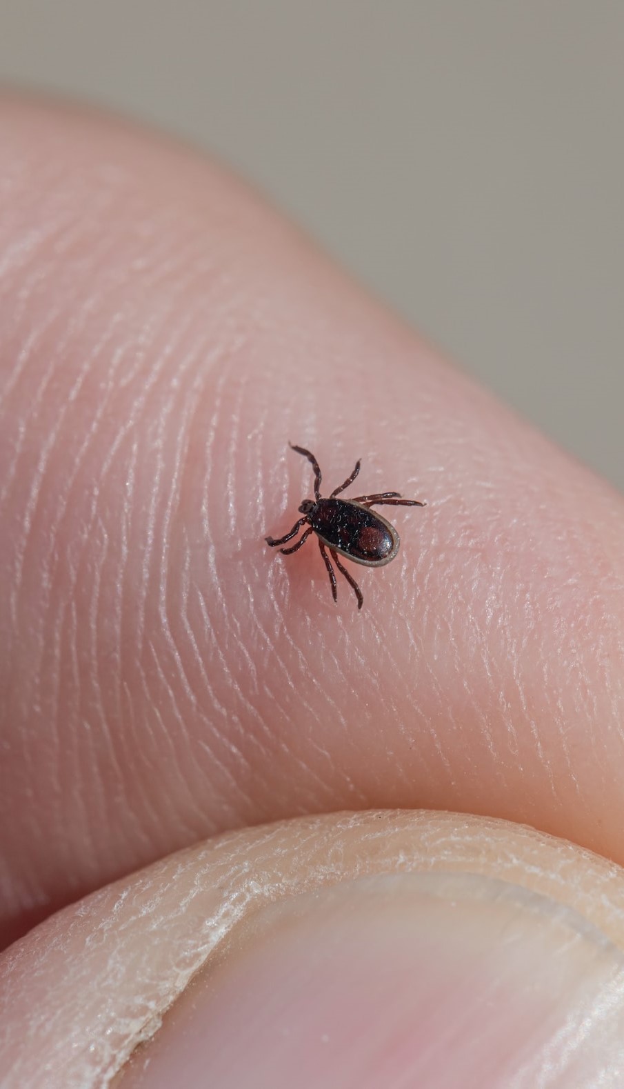 tick – TickCheck Shop