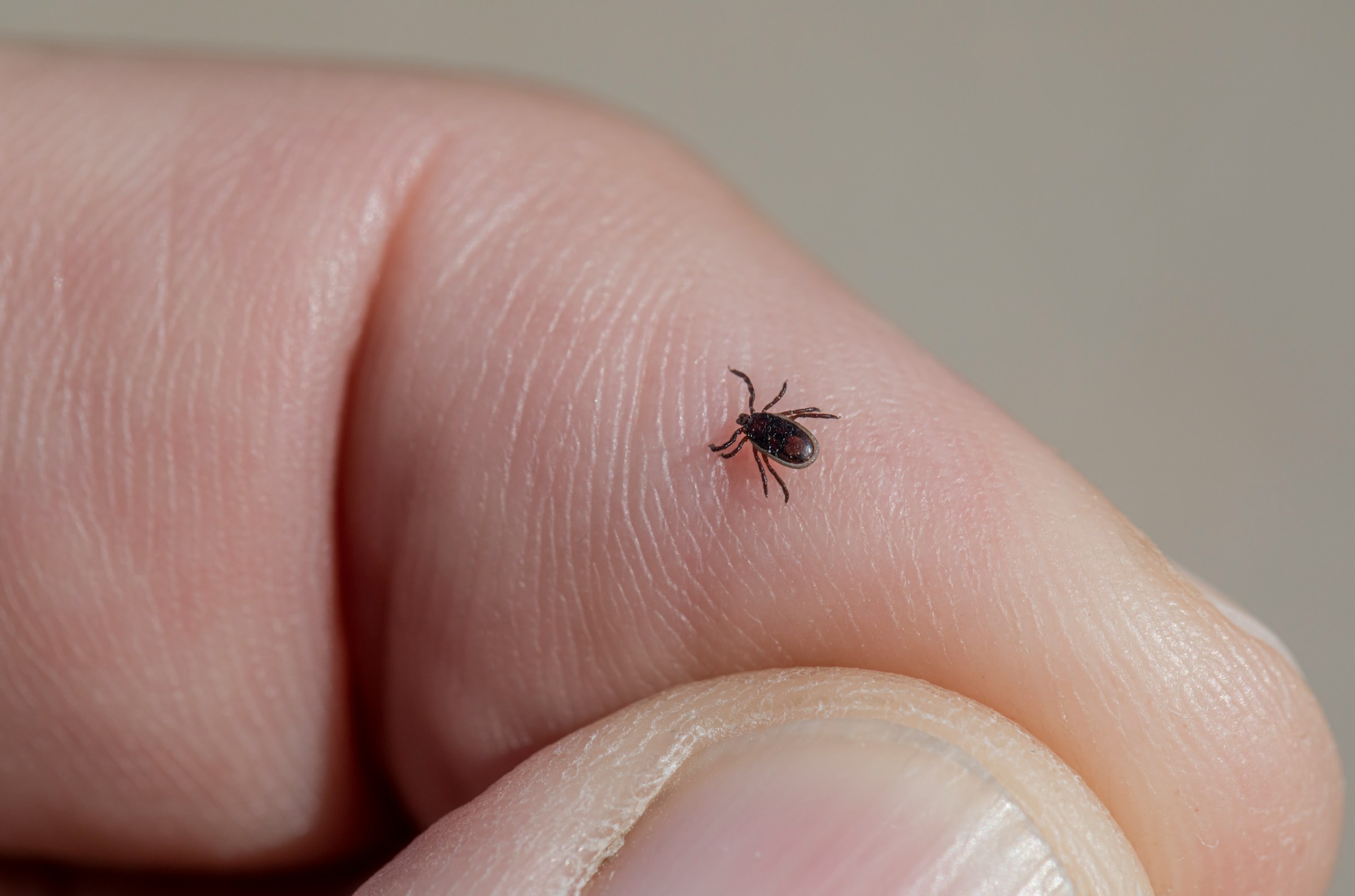 What to Do After a Tick Bite: A Step-by-Step Guide – TickCheck Shop